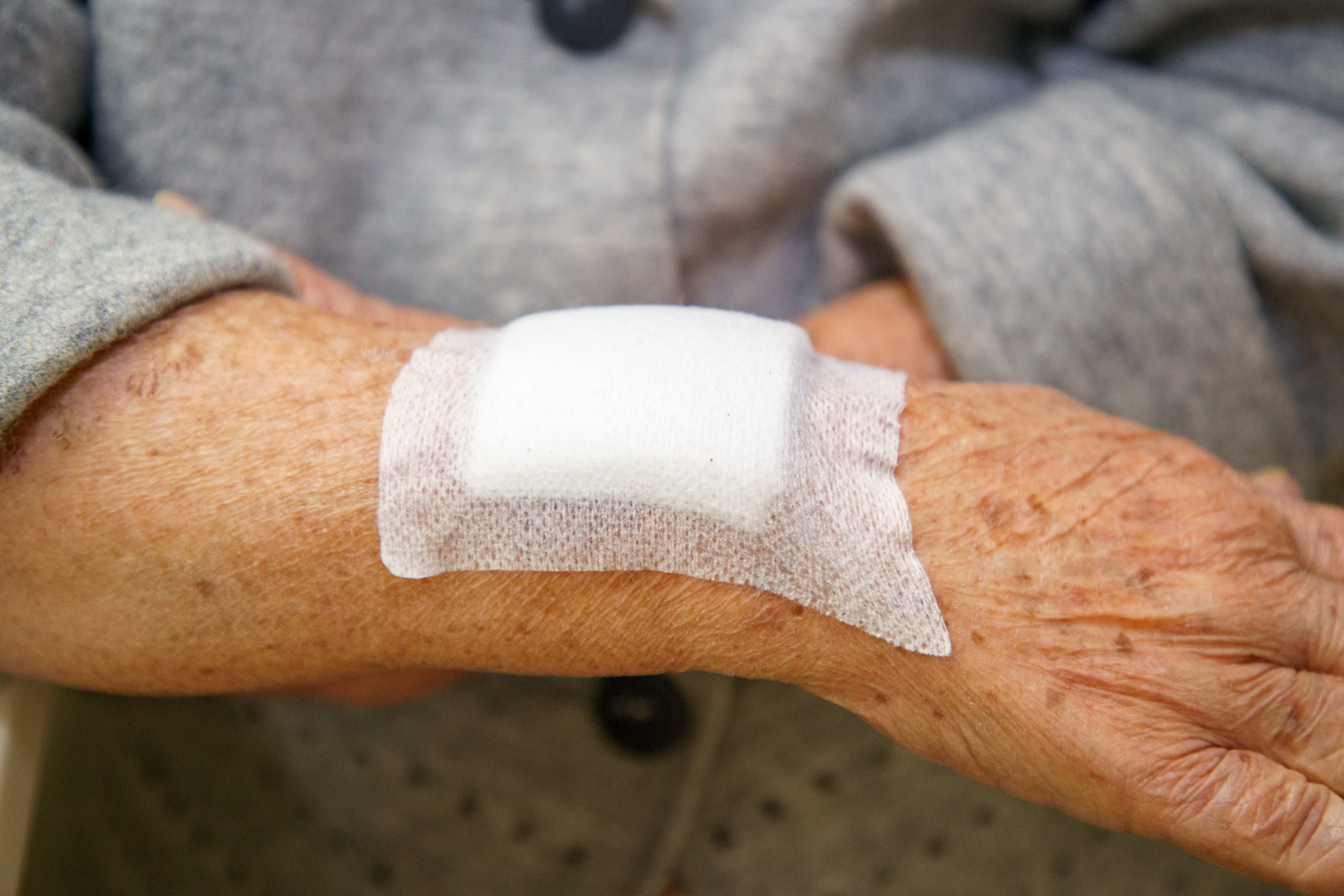 Everything You Need to Know About Wound Care at R3, Texas Everything You Need to Know About Wound Care at R3, Texas